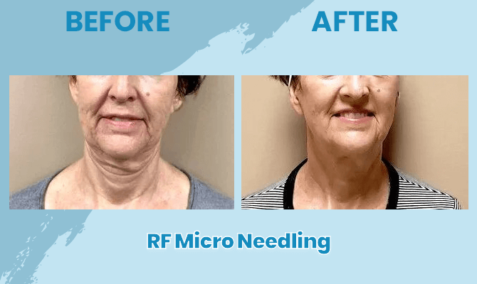 Advanced Image Med Spa & Wellness Center | Glendale, AZ