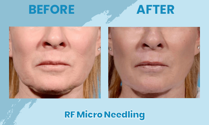 Advanced Image Med Spa & Wellness Center | Glendale, AZ