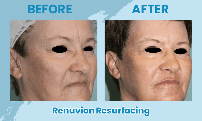 Advanced Image Med Spa & Wellness Center | Glendale, AZ