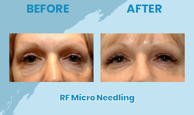 Advanced Image Med Spa & Wellness Center | Glendale, AZ