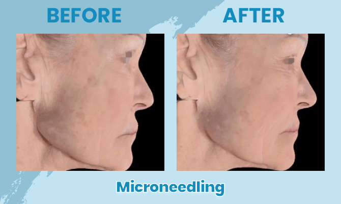 Advanced Image Med Spa & Elite Wellness Center | Glendale, AZ